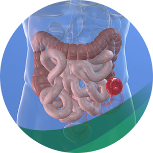 StomTop - The Problem